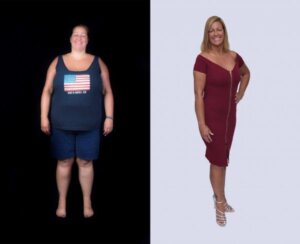 Bariatric Surgery - Covenant Health