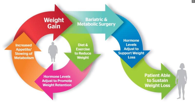 Bariatric Surgery - Covenant Health